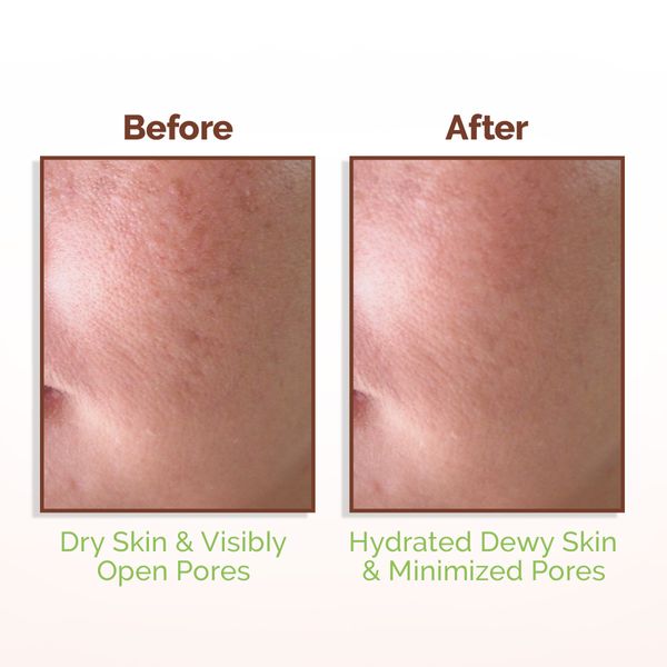 Mamaearth Rice Toner for Face with Rice Water Extract