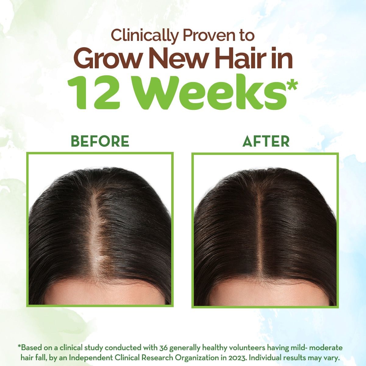 Rosemary oil for hair loss store